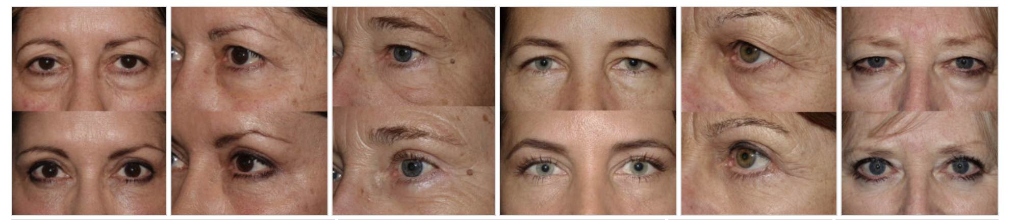 Dr. Guy Massry: The Gold Standard in Oculoplastic Surgery | Groomed LA